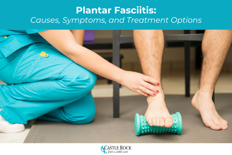 Plantar Fasciitis: Causes, Symptoms, and Treatment Options | Castle ...