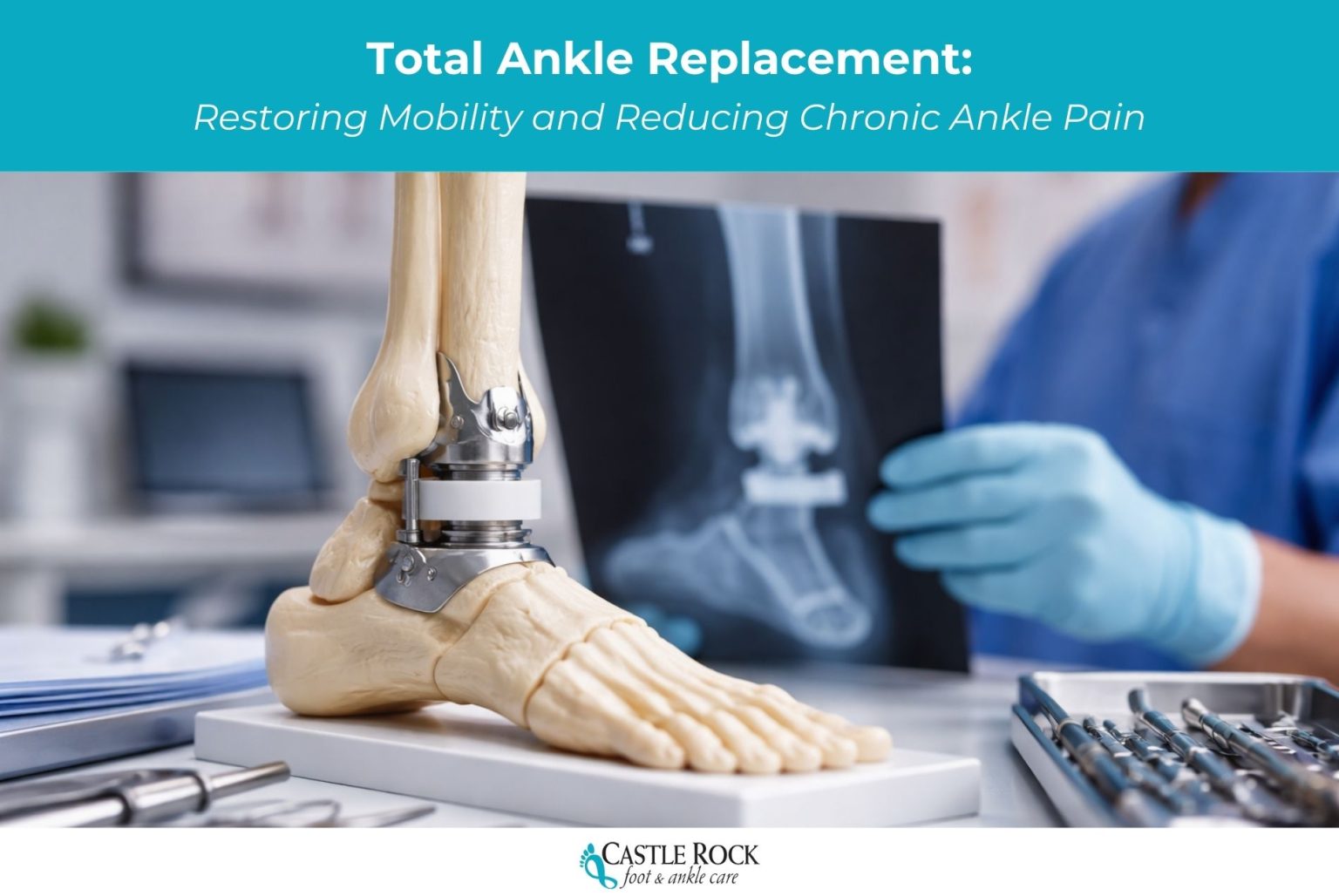 Total Ankle Replacement: Restoring Mobility and Reducing Chronic Ankle ...